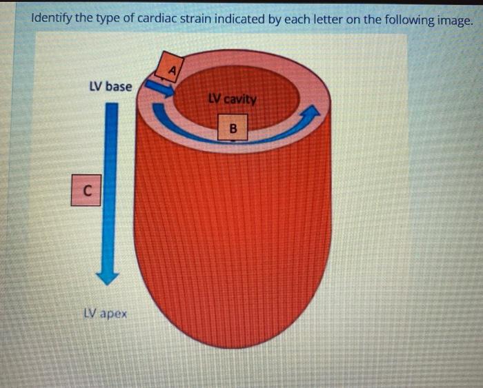 Solved Ultrasound Physics 1. Identify the type of cardiac | Chegg.com