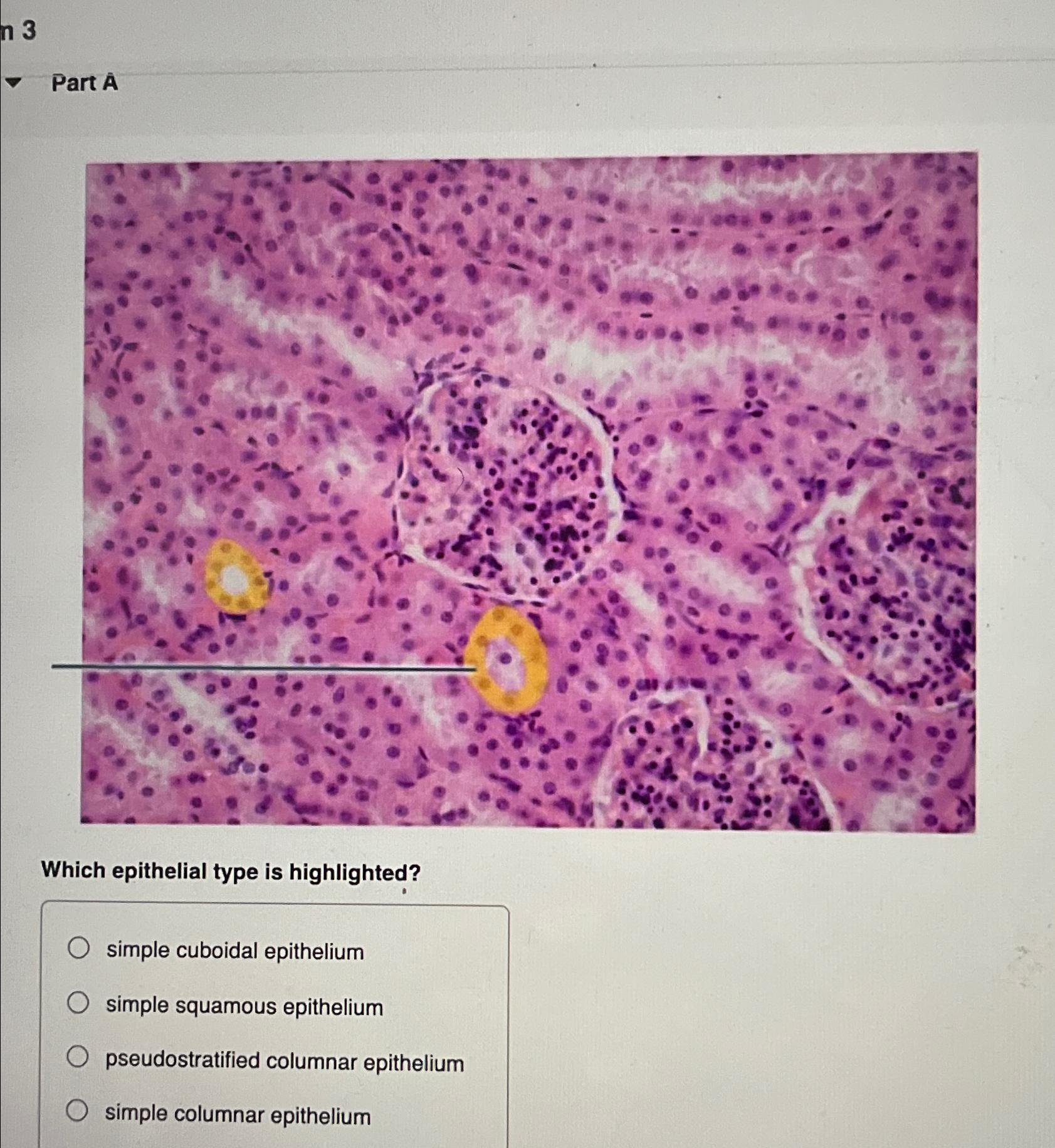 Solved n 3Part AWhich epithelial type is highlighted?simple | Chegg.com
