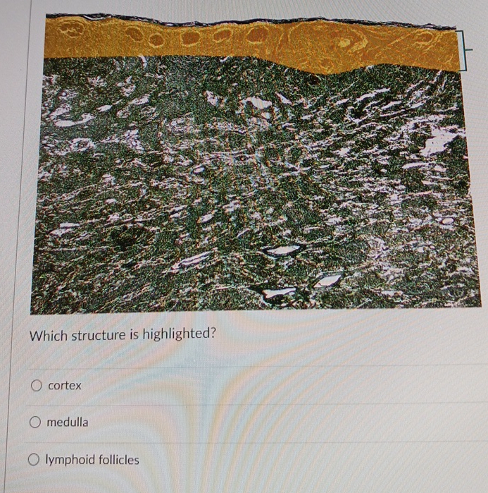 Solved Which structure is highlighted?cortexmedullalymphoid | Chegg.com