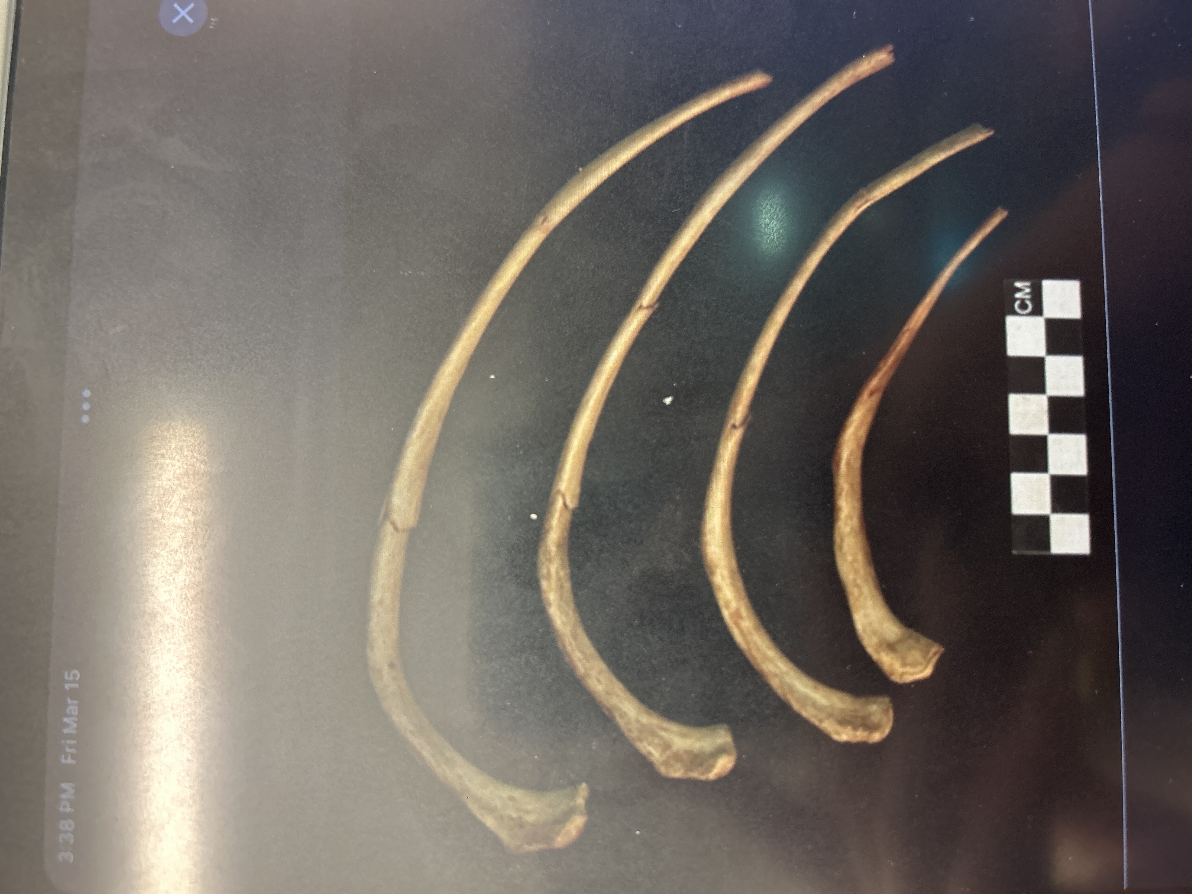 Solved what type of frafture is displayed in tne image. | Chegg.com