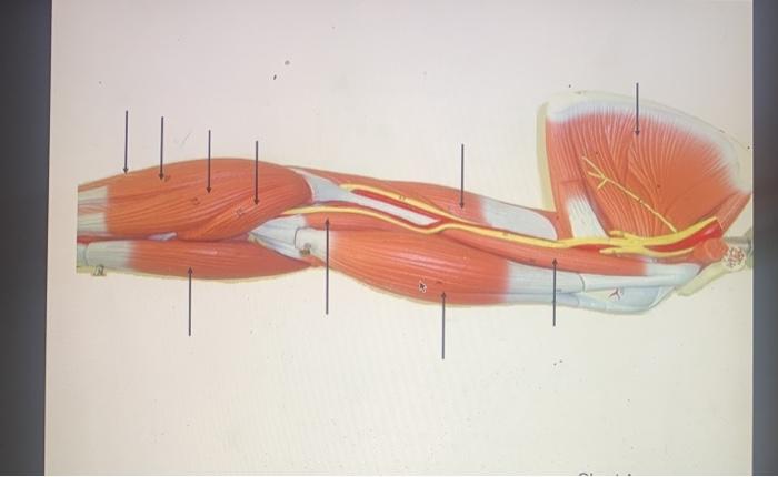 Solved Short Arm Anterior Full Upper Limb showing the medial | Chegg.com