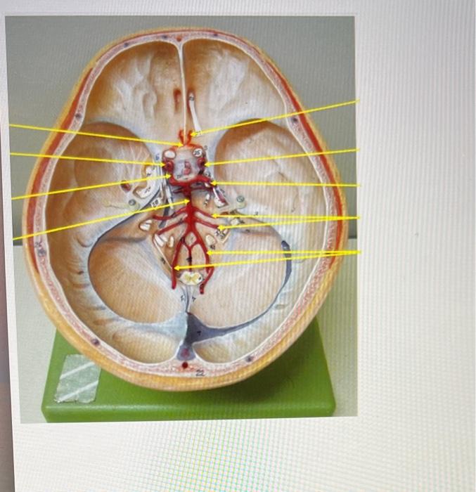 Solved label nerves | Chegg.com