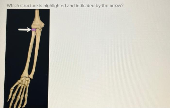 Solved a. capitulum b. trochlea c. head of radius d. radial | Chegg.com