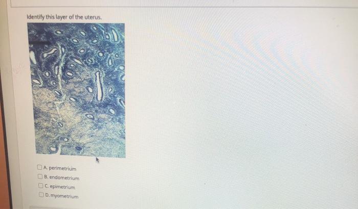 Solved Identify this layer of the uterus. A perimetrium B. | Chegg.com