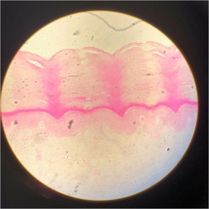 Solved Identify the following thick skin structures in the | Chegg.com