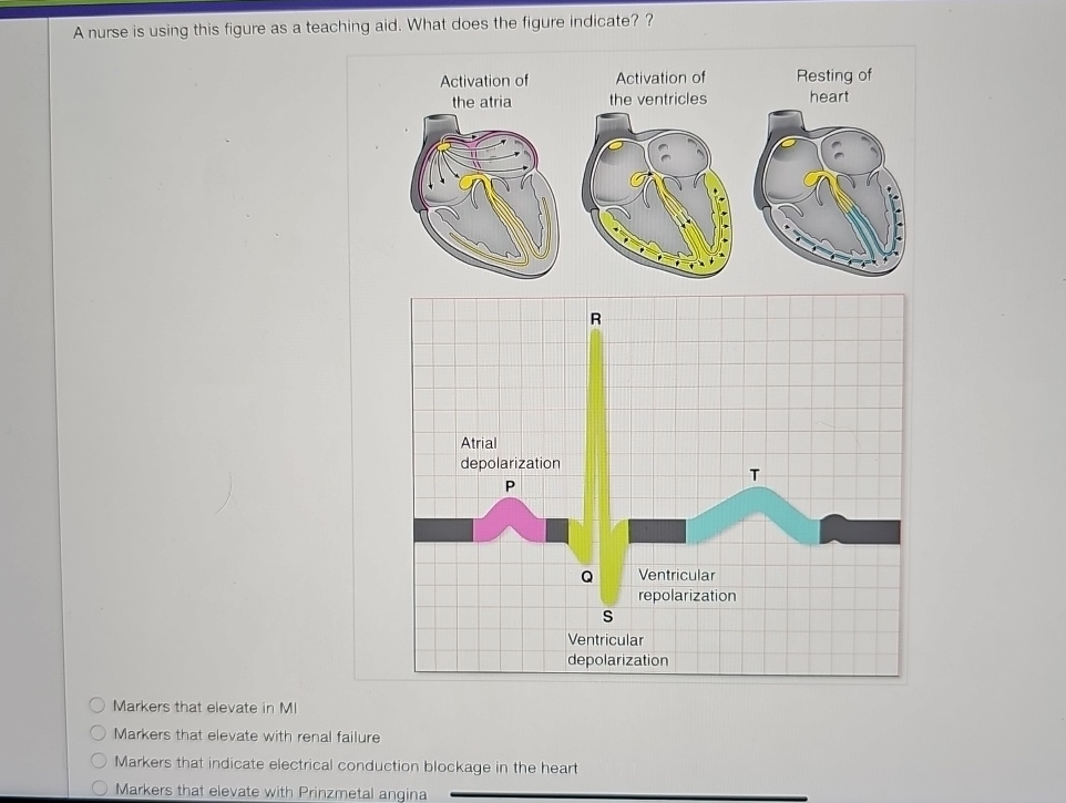 Solved A nurse is using this figure as a teaching aid. What | Chegg.com