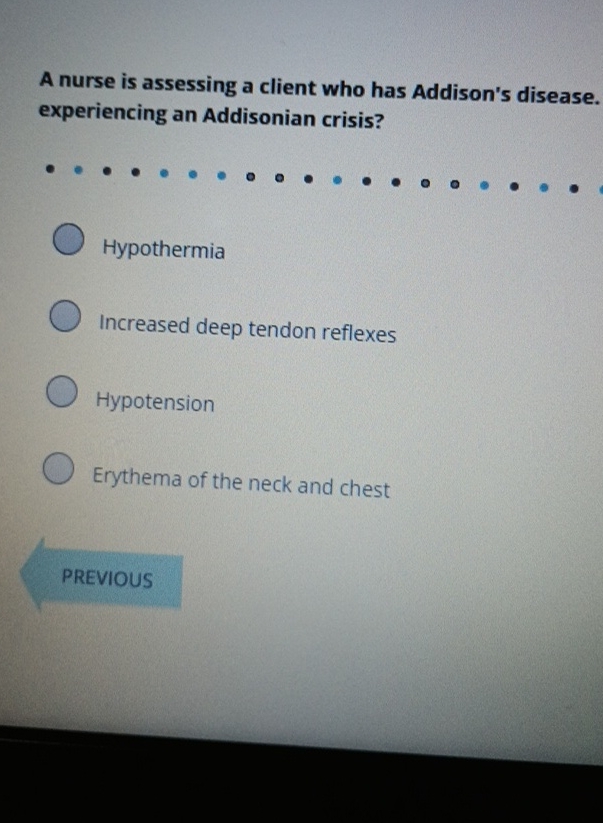 A nurse is assessing a client who has Addison's | Chegg.com