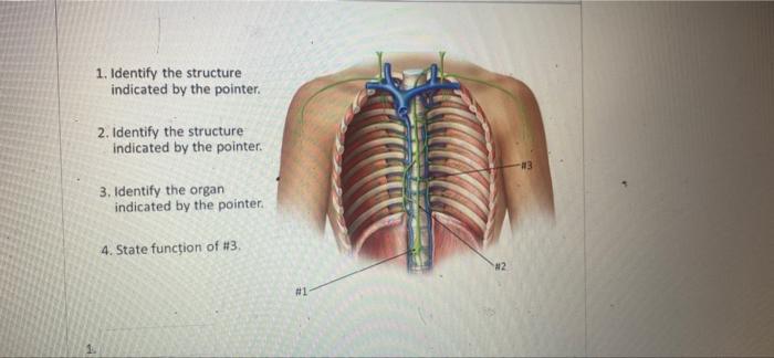 Solved 1. Identify the structure indicated by the pointer. | Chegg.com