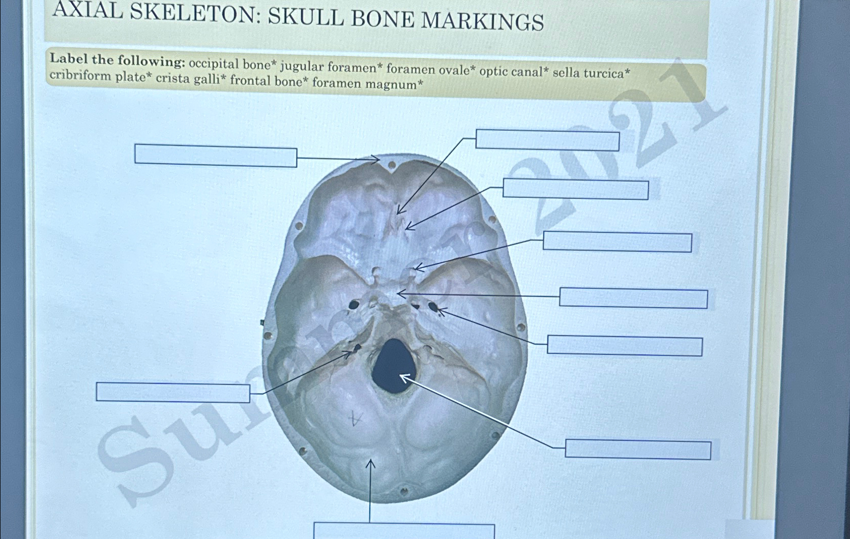 Solved AXIAL SKELETON: SKULL BONE MARKINGSLabel the | Chegg.com