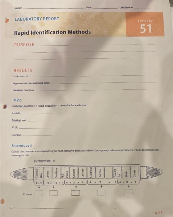 um Lab Section LABORATORY REPORT EXERCISE 51 Rapid | Chegg.com