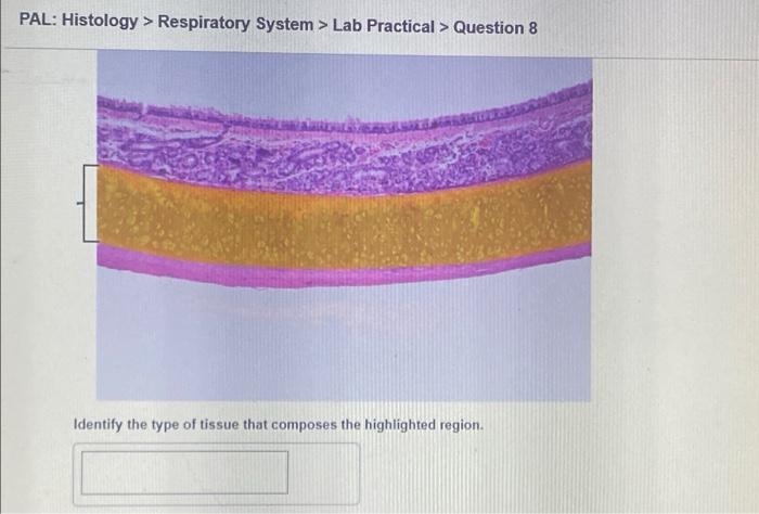 Solved PAL: Histology > Muscular Tissue > Lab Practical > | Chegg.com