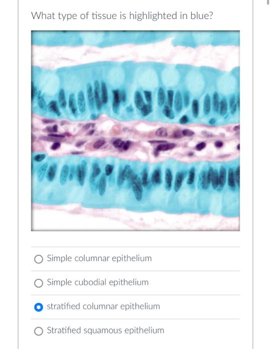 Solved What type of tissue is highlighted in blue? Simple | Chegg.com
