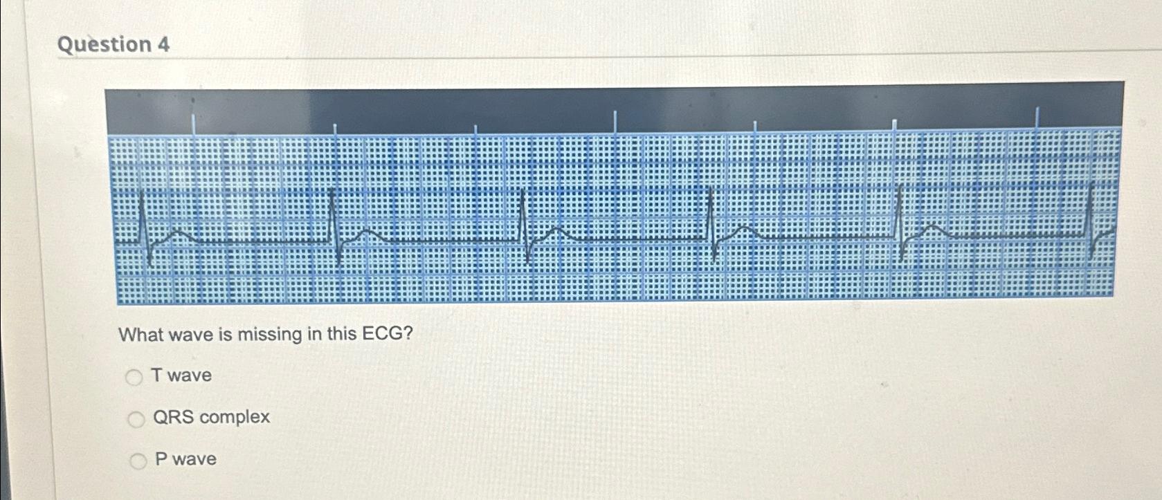 Solved Question 4What wave is missing in this ECG?T waveQRS | Chegg.com