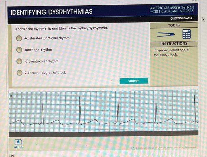 Solved IDENTIFYING DYSRHYTHMIAS AMERICAN ASSOCIATION | Chegg.com