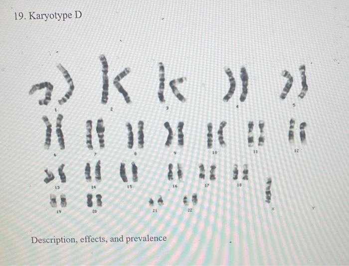 Solved 19. Karyotype D 2) k k ) ? » Still! & 2714 33 MO 22 | Chegg.com