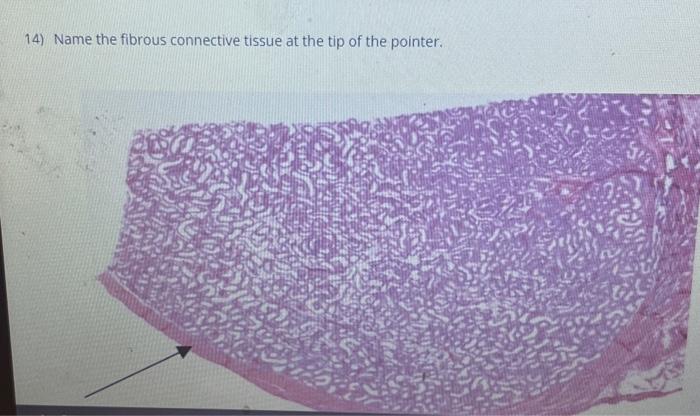 Solved 14) Name the fibrous connective tissue at the tip of | Chegg.com