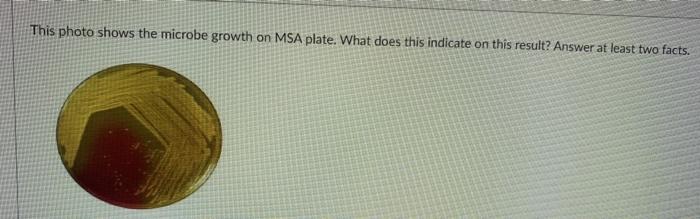 Solved This photo shows the microbe growth on MSA plate. | Chegg.com