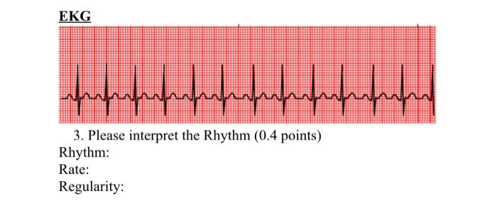 Solved 3. Please interpret the Rhythm ( 0.4 points) Rhythm: | Chegg.com