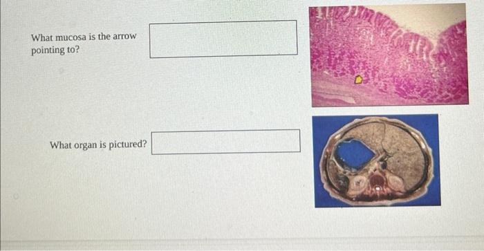 Solved What structure is pictured? What mucosa is the arrow | Chegg.com