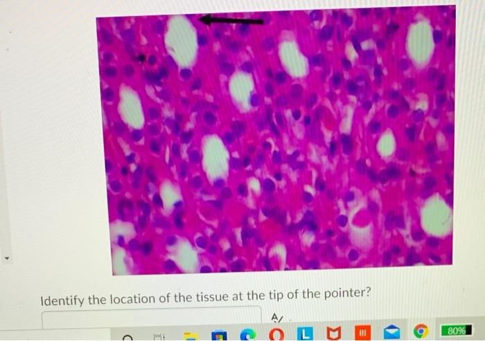 Solved Identify the location of the tissue at the tip of the | Chegg.com