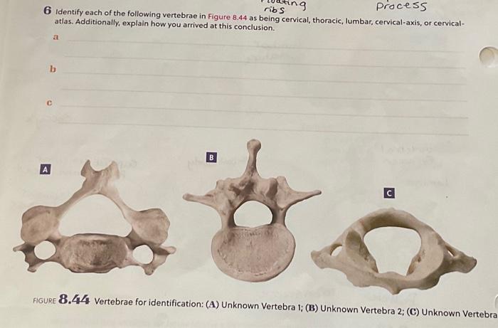 Solved 6 Identify each of the following vertebrae in Figure | Chegg.com