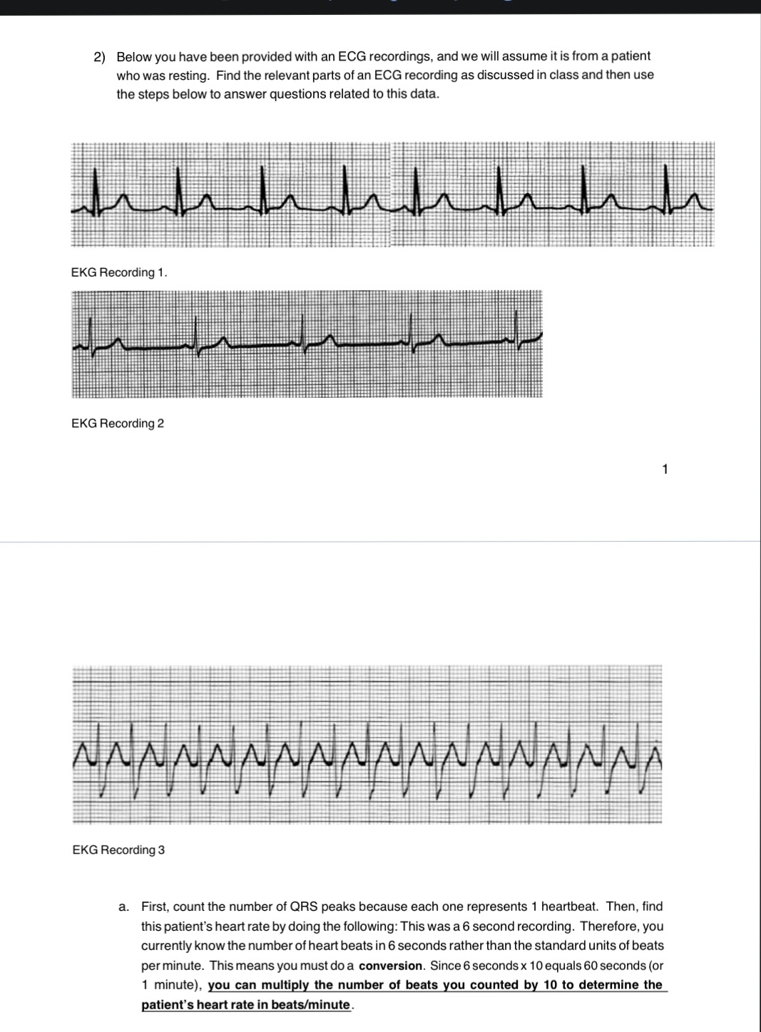 Solved Below you have been provided with an ECG recordings, | Chegg.com