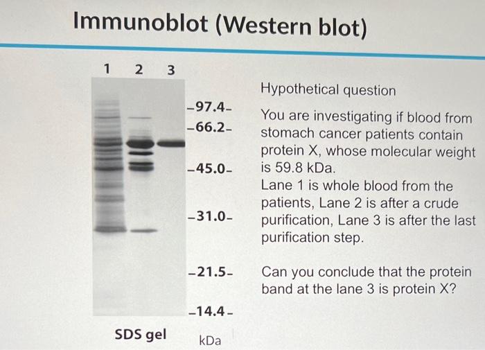 Solved Immunoblot (Western blot) | Chegg.com