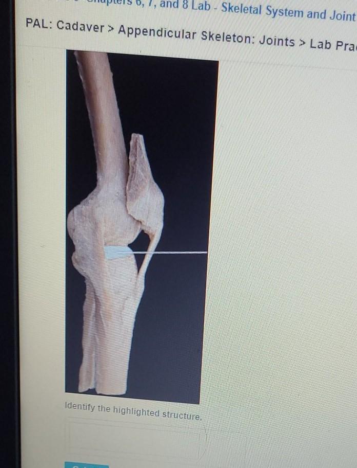 Solved 1, and 8 Lab - Skeletal System and Joint PAL: Cadaver | Chegg.com