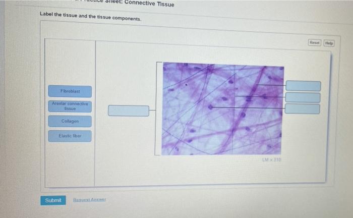 Solved Connective Tissue Label the tissue and the tissue | Chegg.com