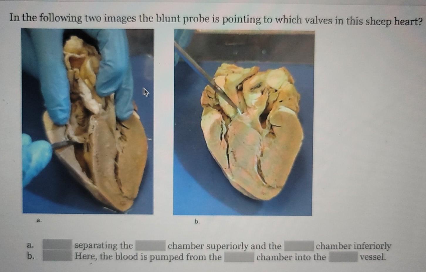 Solved In the following two images the blunt probe is | Chegg.com