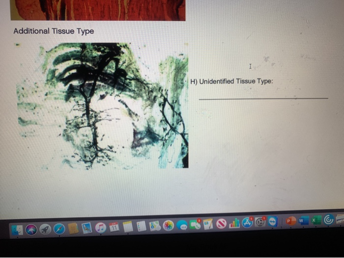Solved Additional Tissue Type - H) Unidentified Tissue Type: | Chegg.com