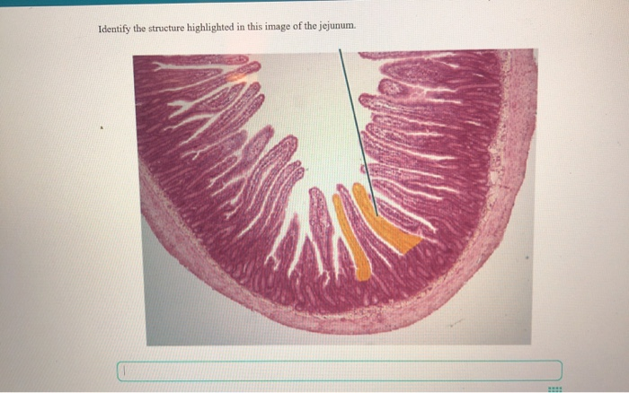 Solved Identify the structure highlighted in this image of | Chegg.com