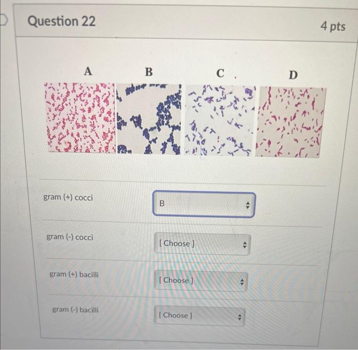 Solved gram (+) cocci gram (-) cocci gram (+) bacilli gram | Chegg.com