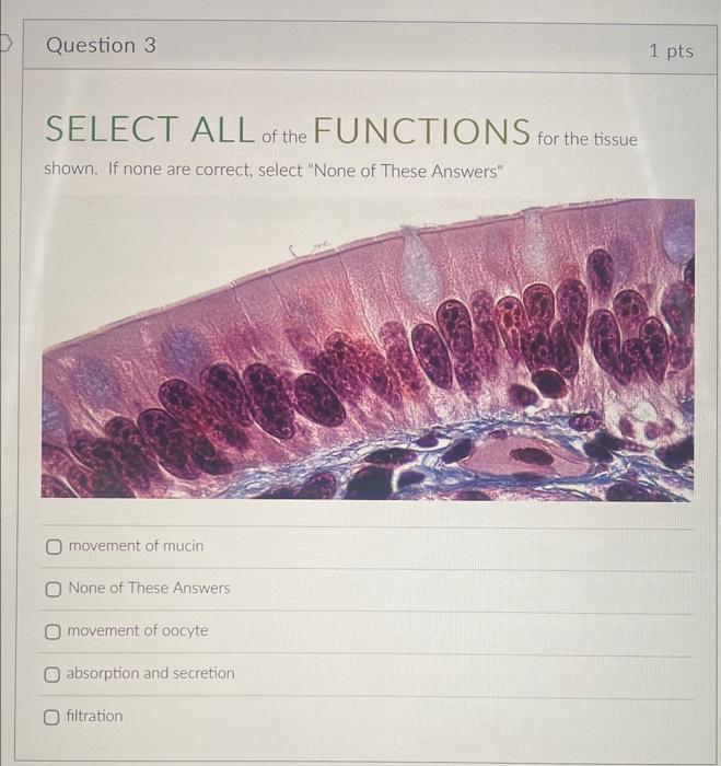 Solved IDENTIFY the FIBER. IDENTIFY the STRUCTURE/FEATURE | Chegg.com Solved IDENTIFY the FIBER. IDENTIFY the STRUCTURE/FEATURE | Chegg.com
