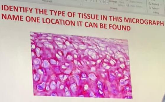 Solved IDENTIFY THE TYPE OF TISSUE IN THIS MICROGRAPH NAME | Chegg.com