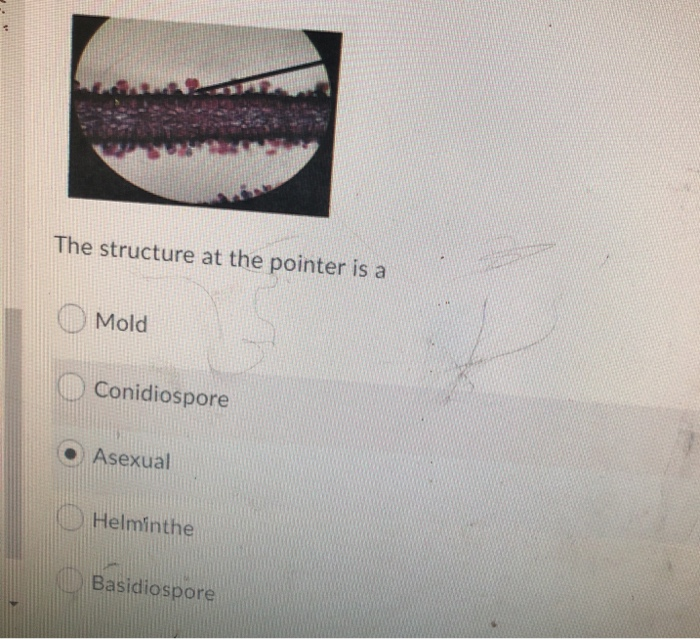 Solved The structure at the pointer is a Mold Conidiospore | Chegg.com