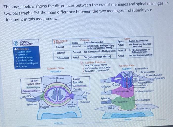 Solved The image below shows the differences between the | Chegg.com