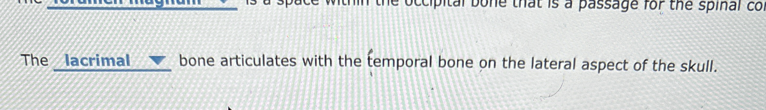 Solved The q, ﻿bone articulates with the temporal bone on | Chegg.com