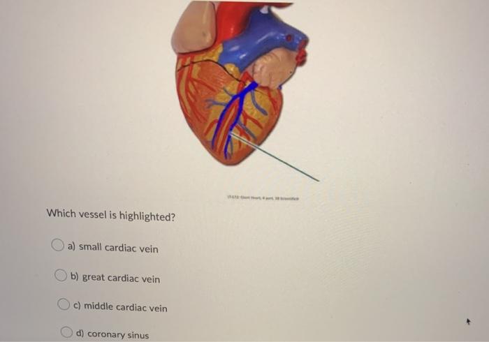 Solved Which structure is highlighted? a) apex of heart b) | Chegg.com