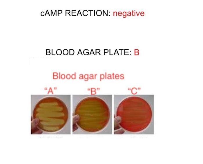 Solved CAMP REACTION: negative BLOOD AGAR PLATE: B Blood | Chegg.com