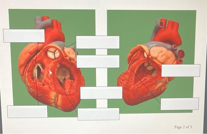 Solved Heart Anatomy Worksheet Word Bank Heart Model | Chegg.com