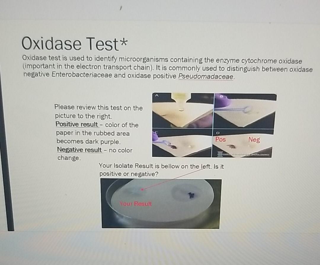 Solved Indole Test The indole test screens for the ability | Chegg.com
