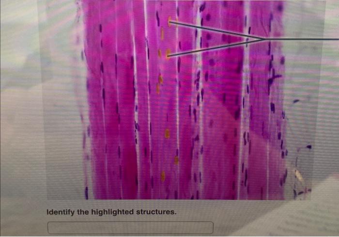 Solved Identify the highlighted structures. | Chegg.com Solved Identify the highlighted structures. | Chegg.com
