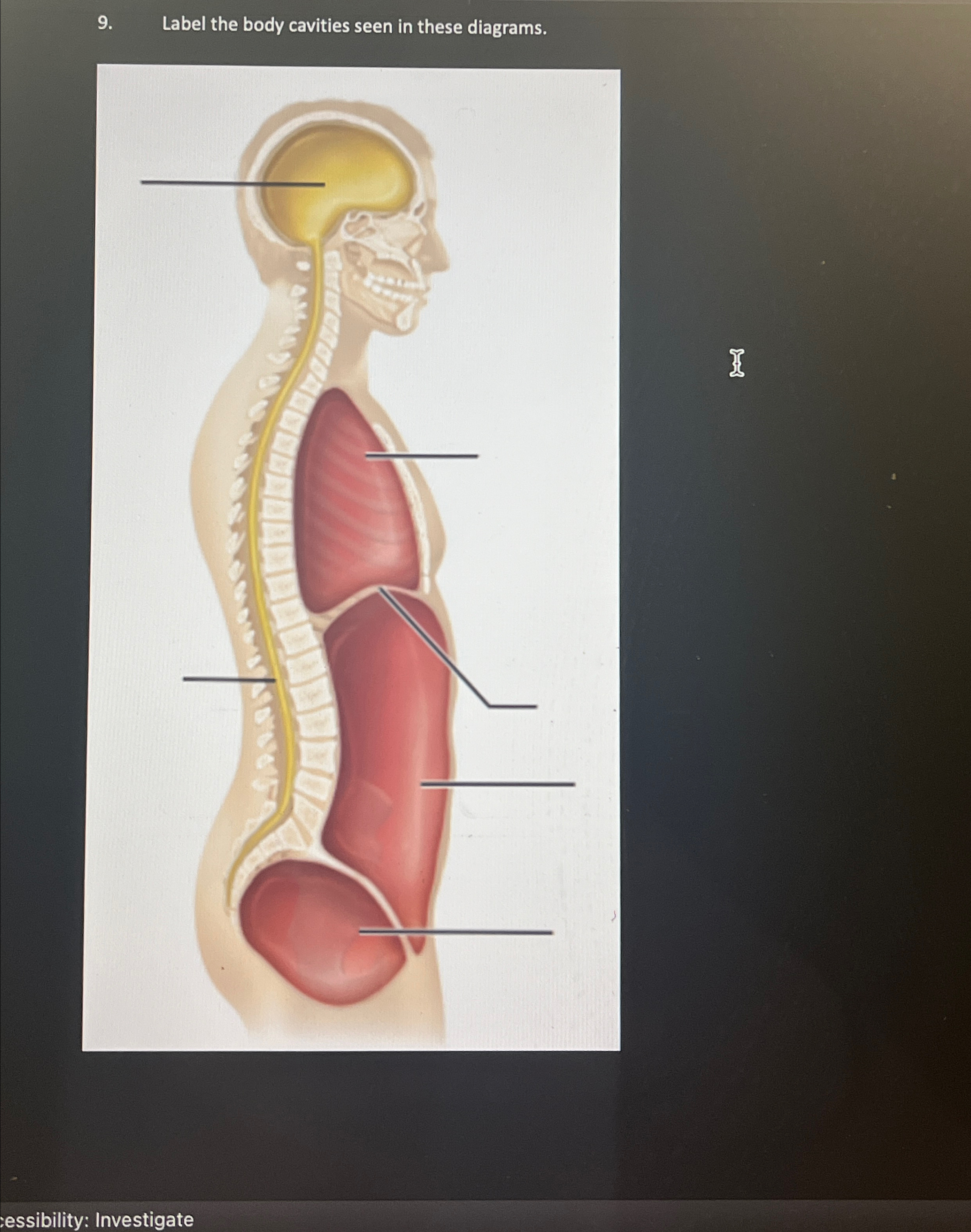 Label the body cavities seen in these | Chegg.com