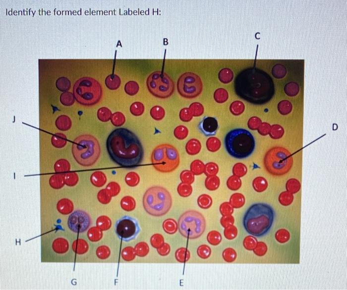 Solved Identify the formed element Labeled H: C A B D H H G | Chegg.com