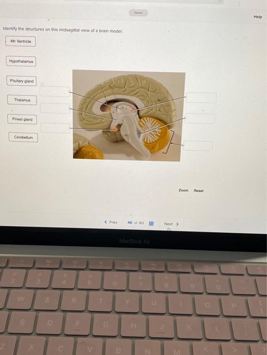 Solved saved Identify the structures on this midsagittal | Chegg.com