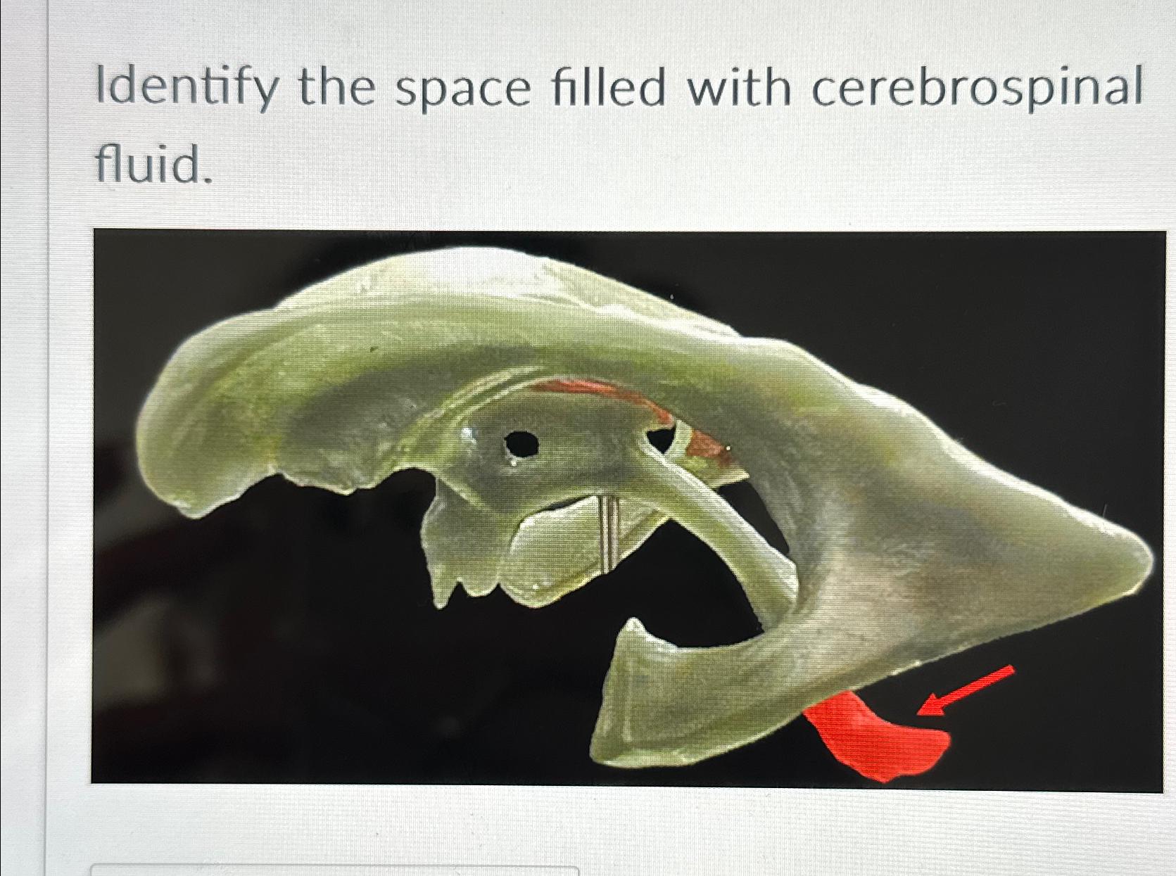 Solved Identify the space filled with cerebrospinal fluid. | Chegg.com Solved Identify the space filled with cerebrospinal fluid. | Chegg.com