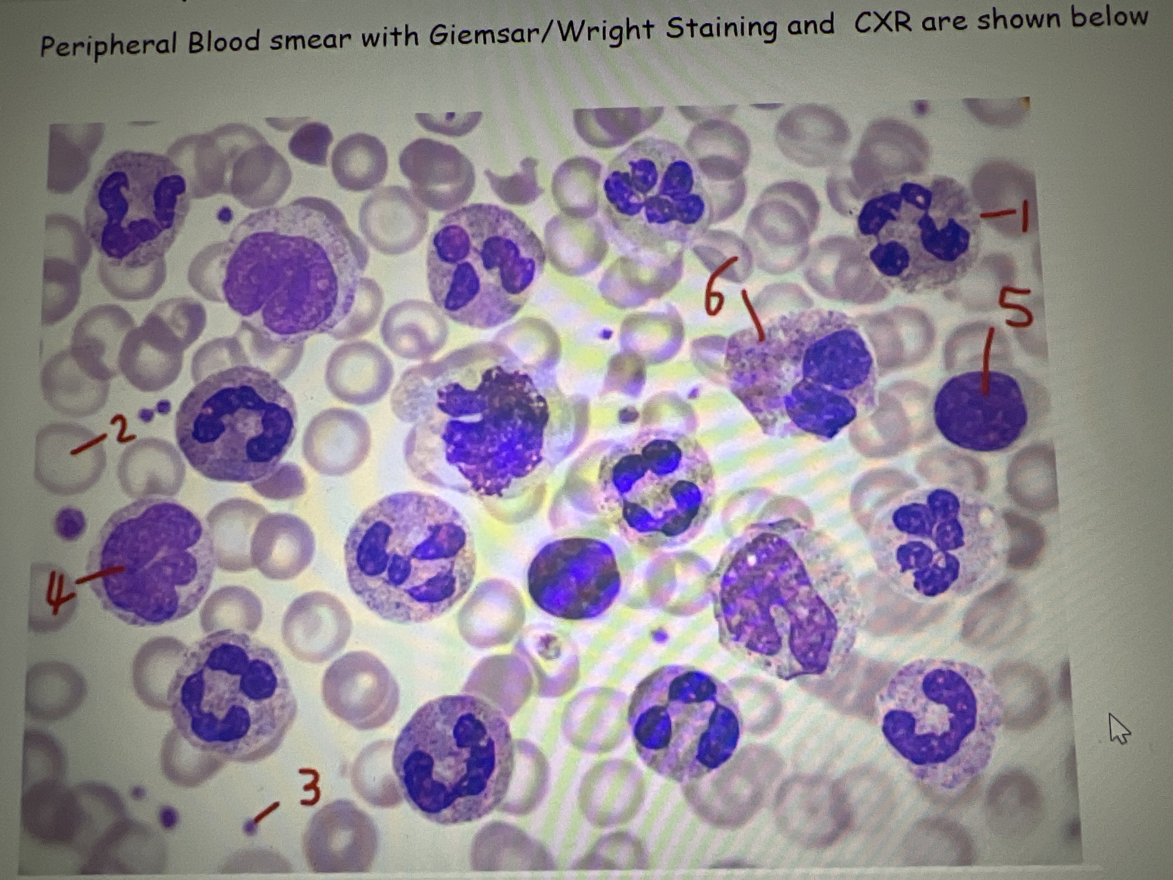 Solved Peripheral Blood smear with Giemsar/Wright Staining | Chegg.com