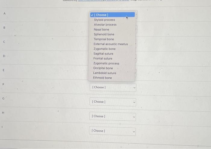 Solved A [Choose] 8 [Choose] c [Choose] D [Choose] | Chegg.com