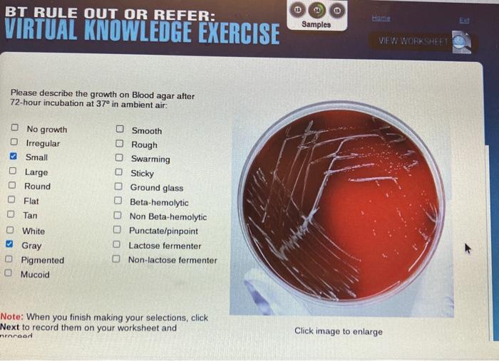 Solved BT RULE OUT OR REFER: VIRTUAL KNOWLEDGE EXERCISE | Chegg.com